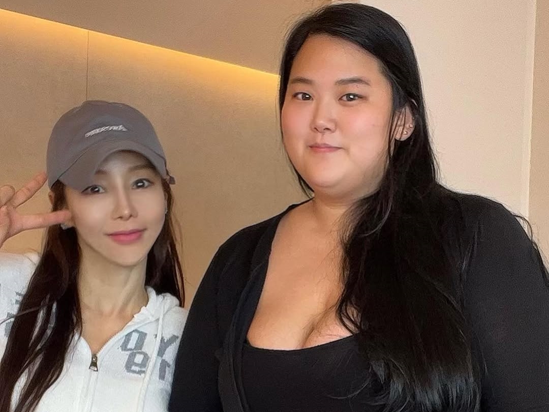 韓国歌手の義姉がダイエット成功！150kg→99kgの衝撃ビフォーアフター「腕の血管見える」【画像】｜スポーツソウル日本版